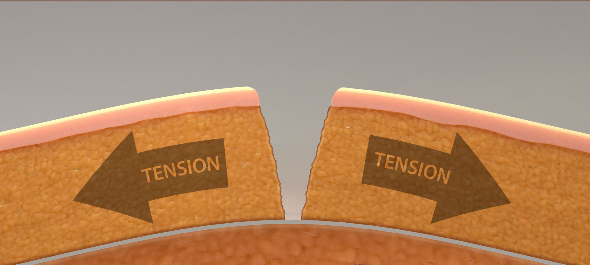 Products - BRIJ Medical