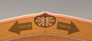 Products - BRIJ Medical