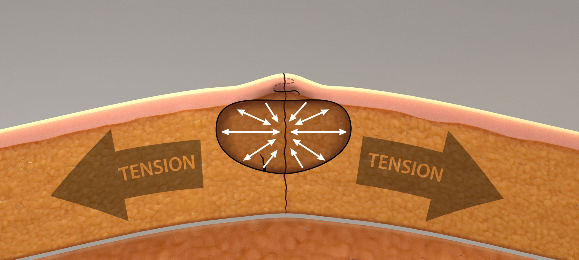 Products - BRIJ Medical