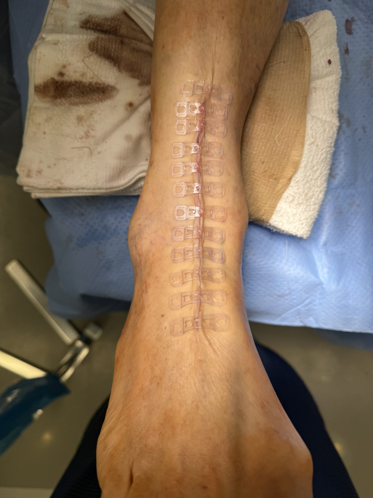 Meet Brijjit® | Offload tension. Optimize healing.